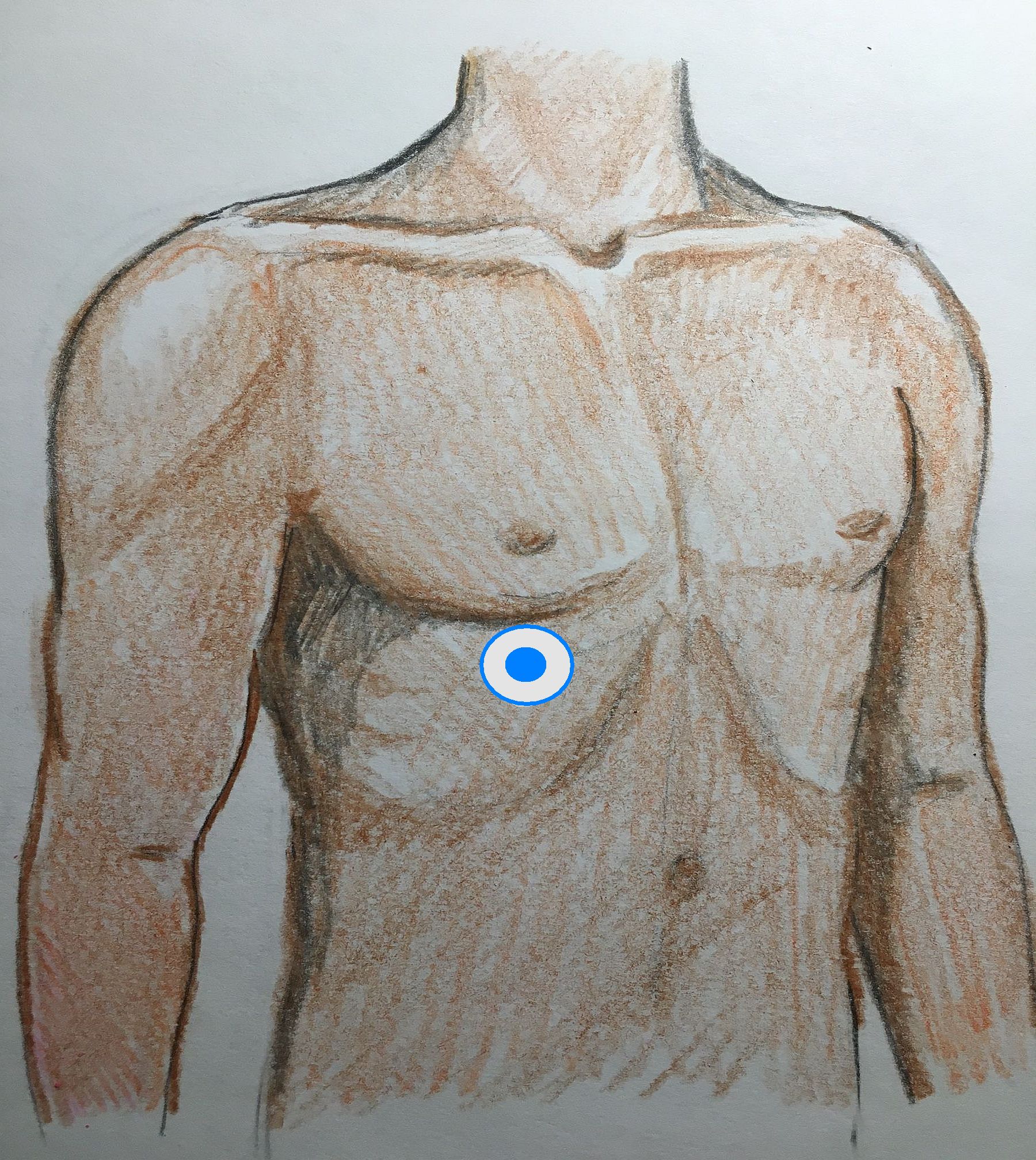 V4 Right ECG Guru Instructor Resources